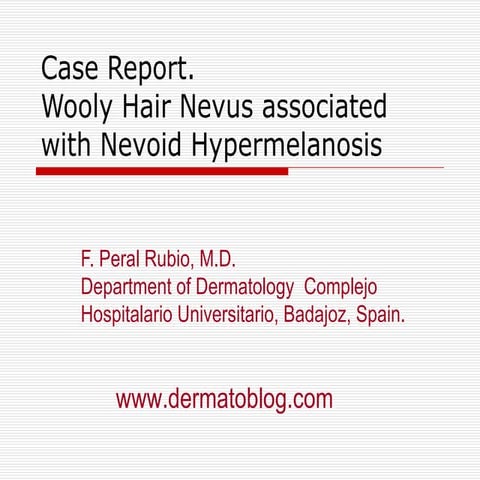 Case report. Wooly hair associated with nevoid hypermelanosis | PPT