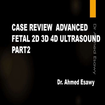 Case review advanced fetal 2 d 3d 4d ultrasound part2 | PPT