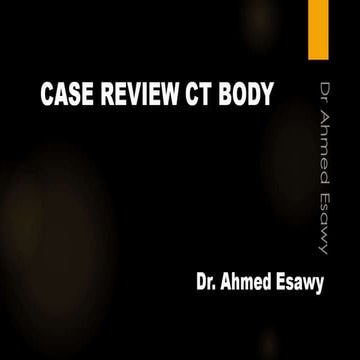 Case review ct body | PPTX