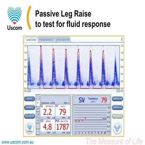 Case Study - Adult - Passive Leg Raise | PPTX