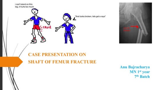 Orthopedics case presentation | PPT