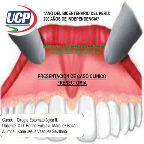 CASO_CLINICO_CIRUGIA_FRENILLO.pptx
