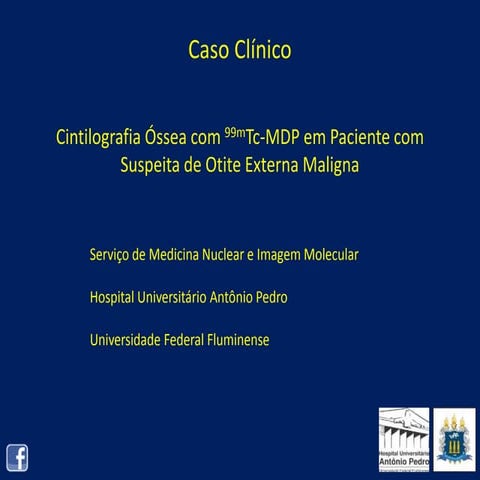 Otite Externa Maligna | PPTX