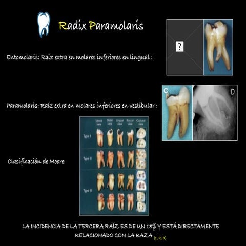 Radix Paramolaris | KEY