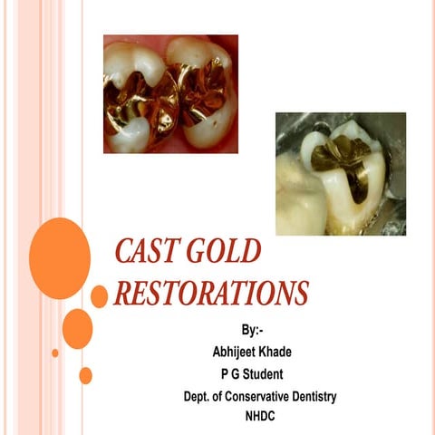 Cast gold Inlay restorations | PPTX