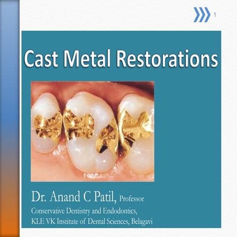 Bevels and flares in dental restoration | PPT