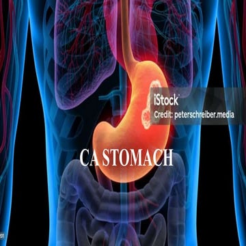 Stomach cancer | PPTX