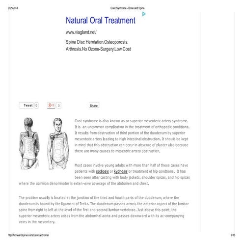 Steps to perform dynamic hip screw ( dhs) | PPTX