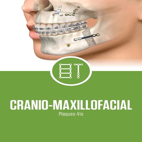 Catalogue 152-163-cranio-maxillofacial | PDF