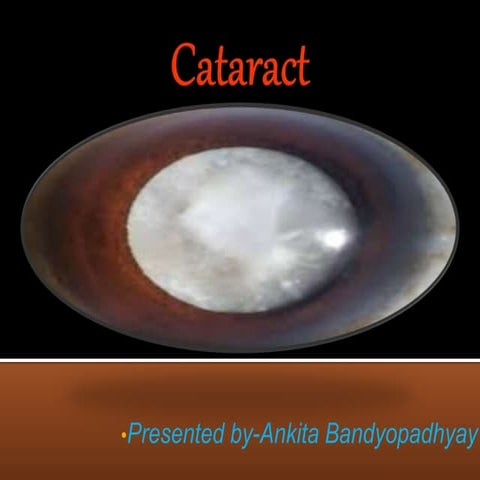CATARACTS CASE PRESENTATION WITH DISEASE INFORMATION | PPTX