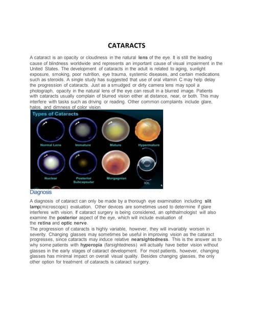 Different Types of Intraocular Lenses in Cataract Surgery.pptx