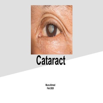 Cataract | PPTX