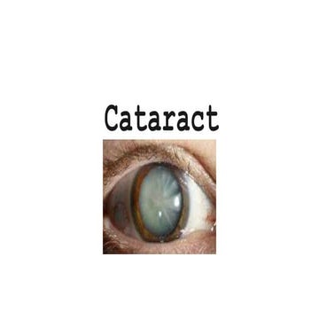 cataract.pptx
