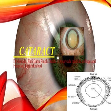 Types Of Cataract | PPTX