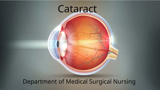 Cataract - Easy PPT for Nursing Students | PDF