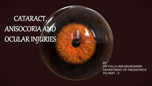 Coralliform Cataract