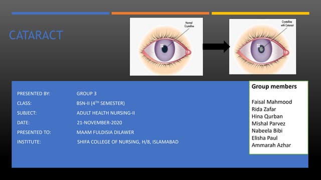 Cataract - Easy PPT for Nursing Students | PDF