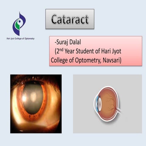 Types Of Cataract | PPTX