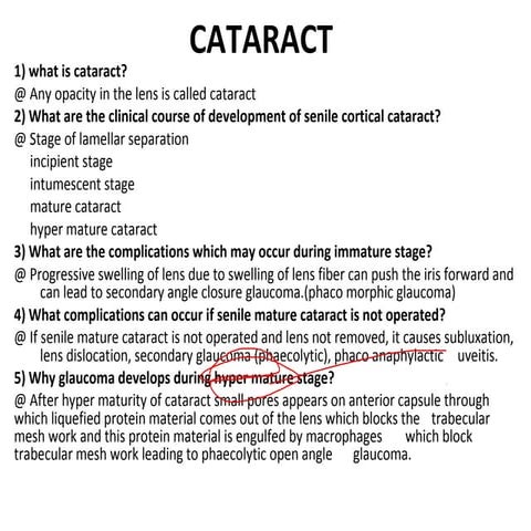 Cataract | PPT