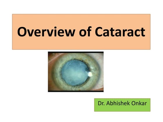 Aetiopathogenesis of cataract | PPTX | Eye and Vision Conditions ...