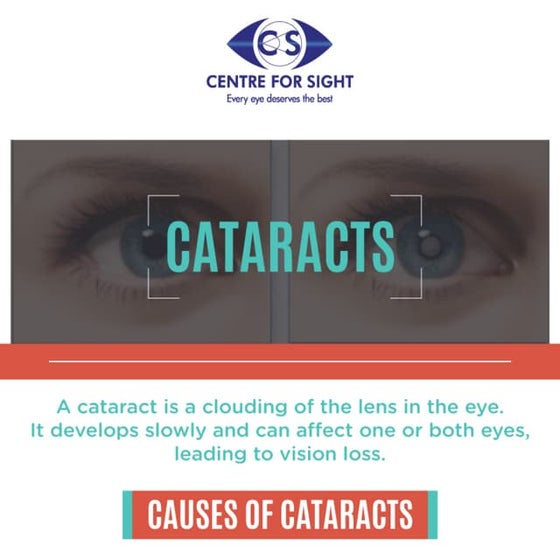 3 Generations of Lasik Procedure | PDF