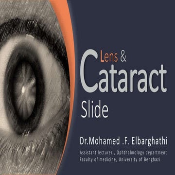 Cataract Slide .pptx