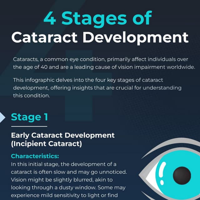 4 Stages of Cataract Development | PDF