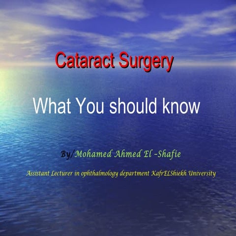 Cataract surgery for undergraduate | PPT
