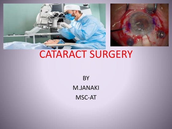 Types of Cataract Surgery.pdf