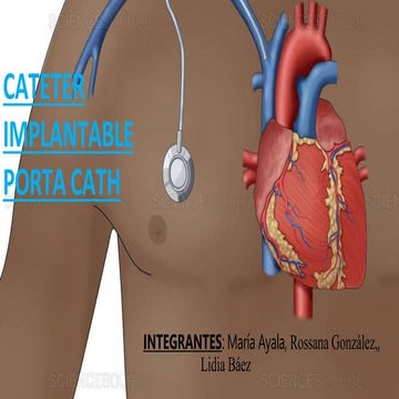 Cateter implantable Porta Cath.pptx
