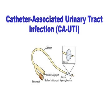 Catheter Associated Urinary Tract Infections (CAUTI) | PPTX