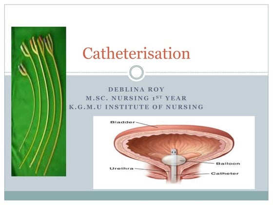 Urinary Catheterization | PPT