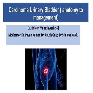 Ca Urinary Bladder anatomy to management | PPTX