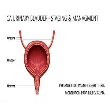 CA URINARY BLADDER - STAGING & MANAGMENT.pptx