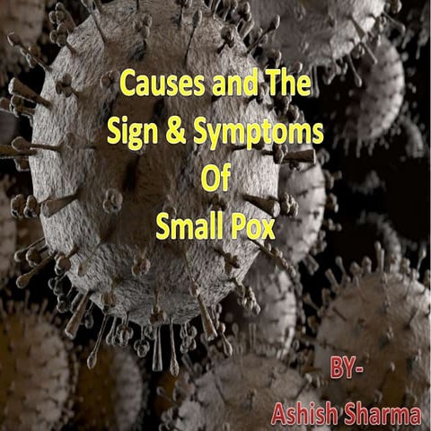 SMALL POX | PPTX | Infectious Diseases | Diseases and Conditions