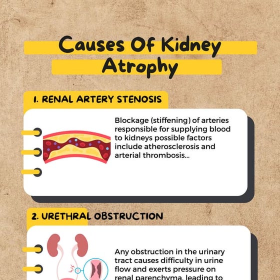 ”KIDNEY ABSCESS” Navigating the journey of cure | PDF