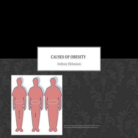 Causes of obesity | PPTX