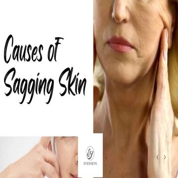 Causes of Sagging Skin | PPT
