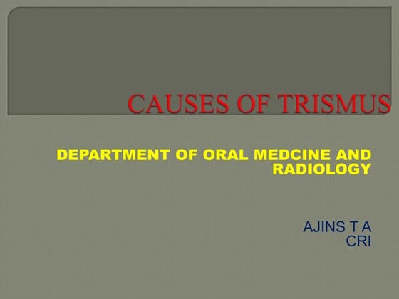 Temporomandibular joint disorder | PPT