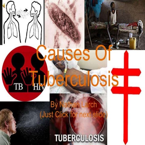 CAUSES OF TUBERCULOSIS POWERPOINT | PPTX