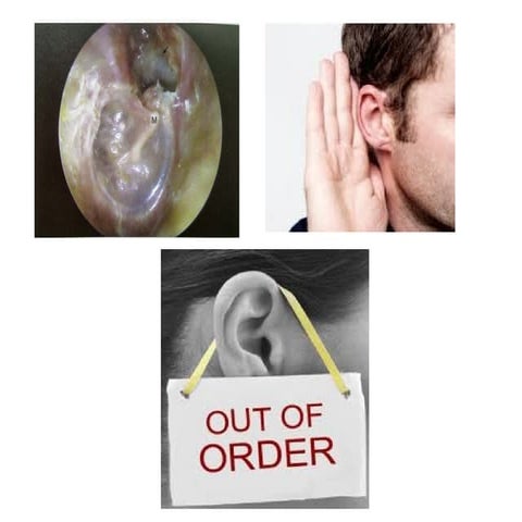 Cavityobliteration3sayan 200821151929 2 Pptx