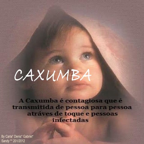 Caxumba | PPT