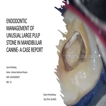 CBD Pulp Stone_Johanes Budiman Khuana.pptx