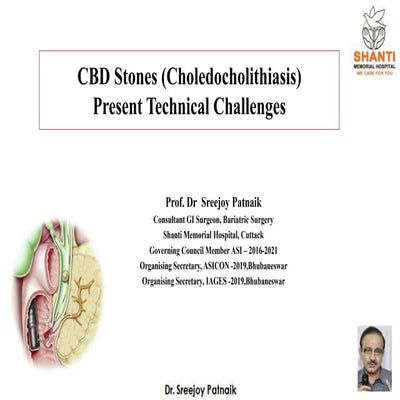 CBD Stones Technical Challenges | PPTX