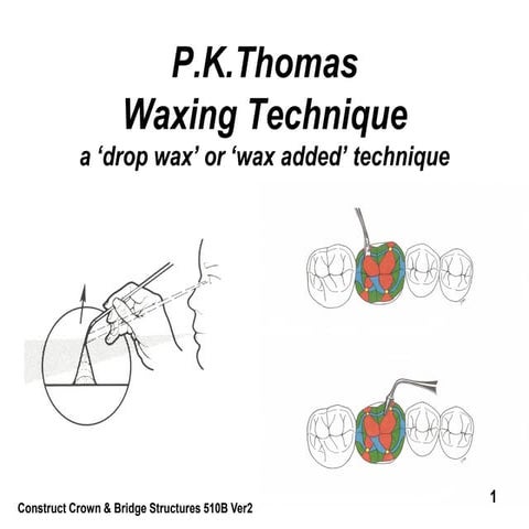 C&b+pk thomas+technique+ver2 | PDF