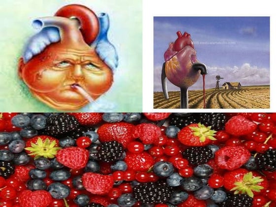 Heart failure disease classification system | PPT