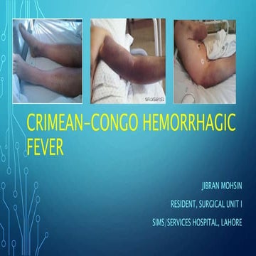 Crimean-Congo Hemorrhagic Fever (CCHF) | PPTX