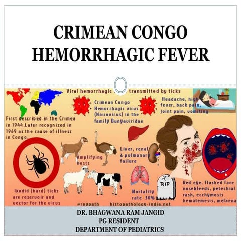 Crimean Congo Hemorrhagic Fever | PPTX