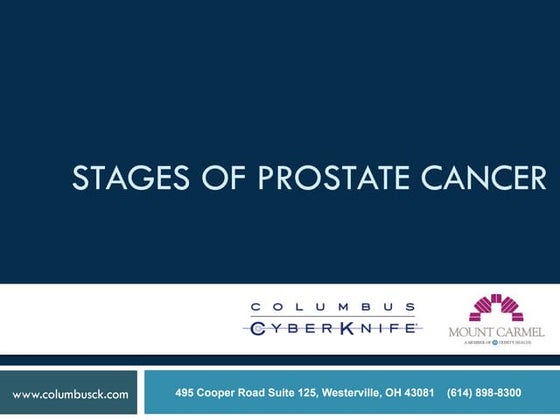 Prostate Cancer: CyberKnife® Treatment Overview | PPT