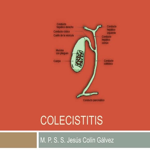 Comprehensive Overview of Acute Cholecystitis: Diagnosis, Severity, and ...